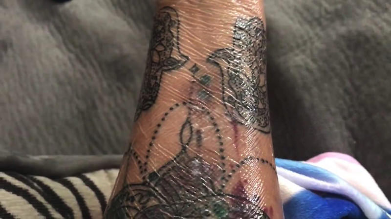 Details More Than 81 Second Skin Tattoo Aftercare Latest In eteachers